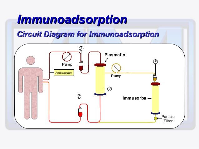 Immunoadsorption to remove ß2 adrenergic receptor antibodies in CFS/ME ...